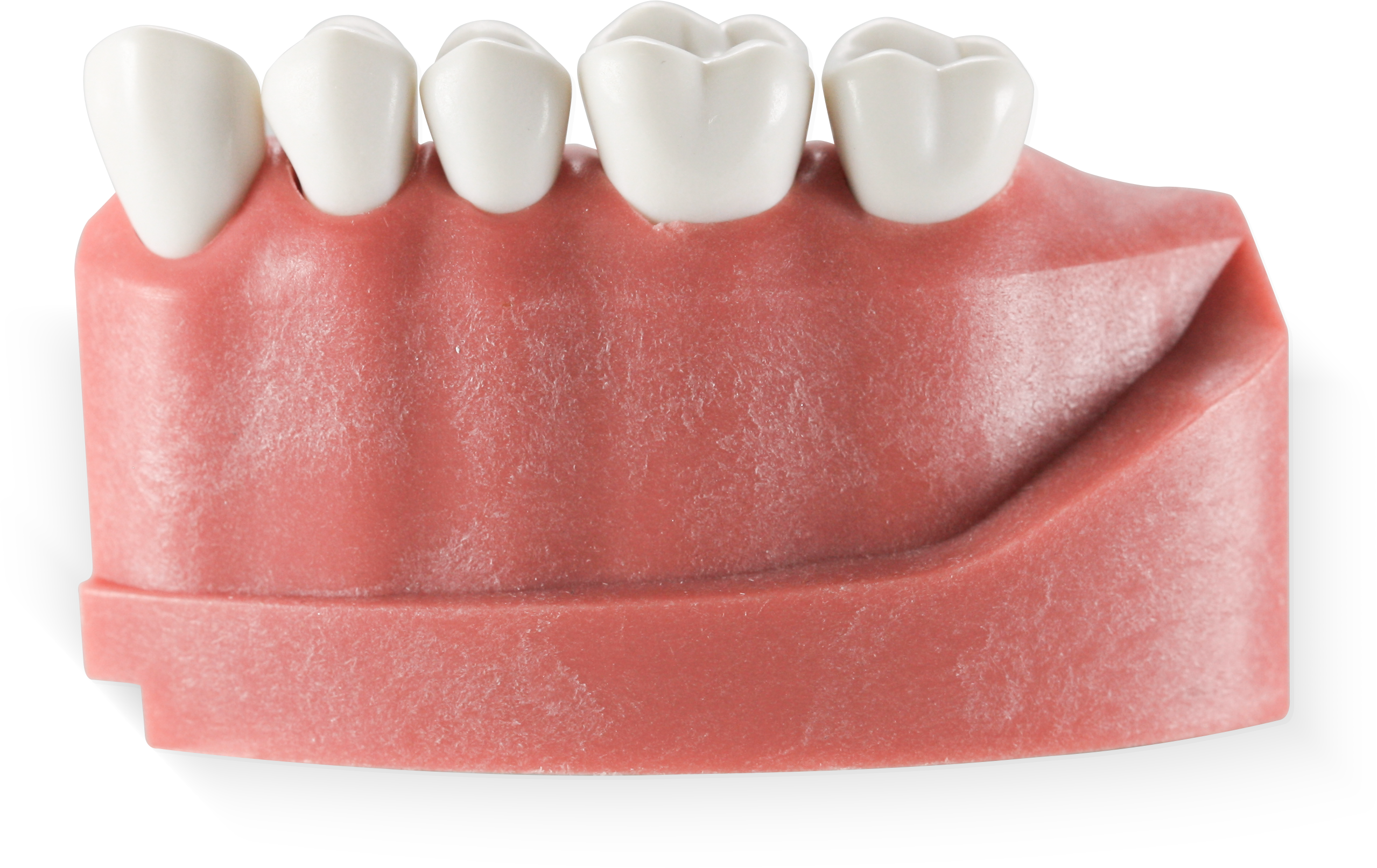 Acadental - MPR Refill Kit