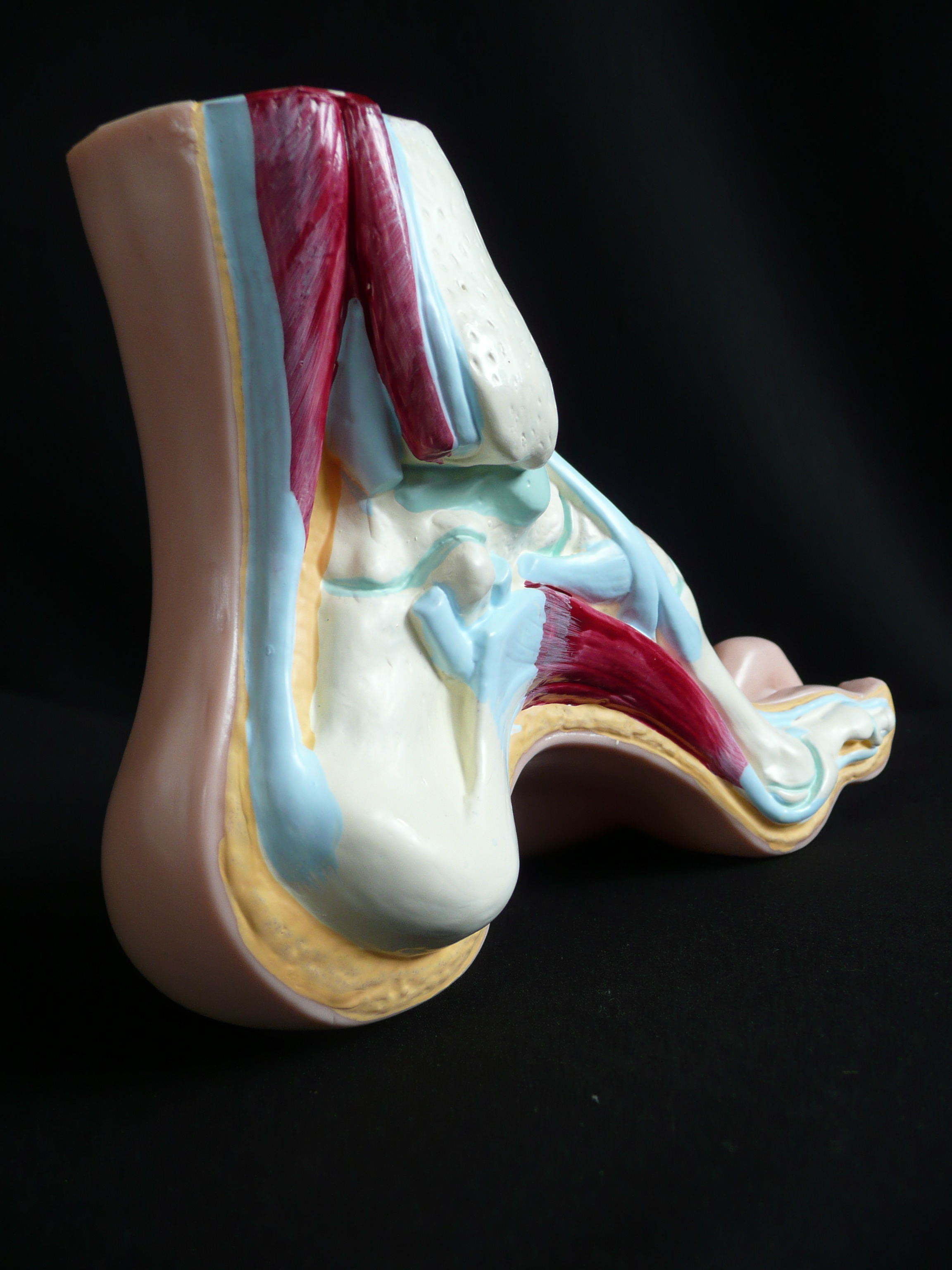 Anatomical Human Normal, Flat and Arched Feet Model | Joints – Store ...